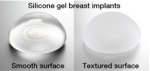 All About Breast Implants - CosMediTour
