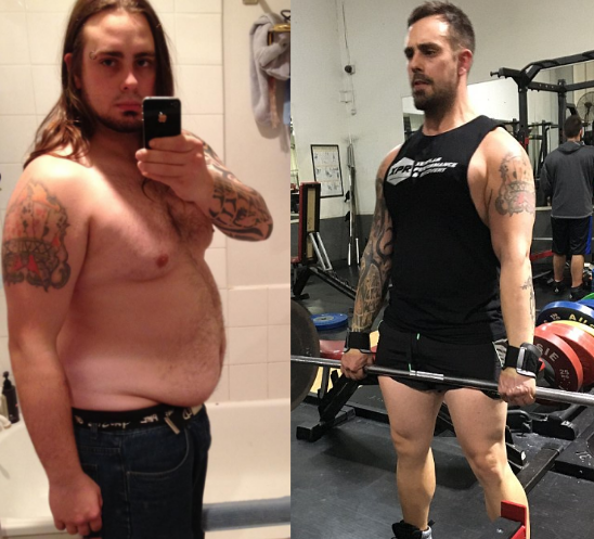 Aspiring Body Builder Features on Operation Thailand for Tummy Tuck ...